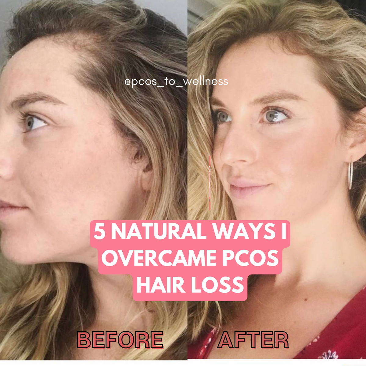 PCOS to Wellness | PCOS Advice for Healing Your Condition Naturally ...